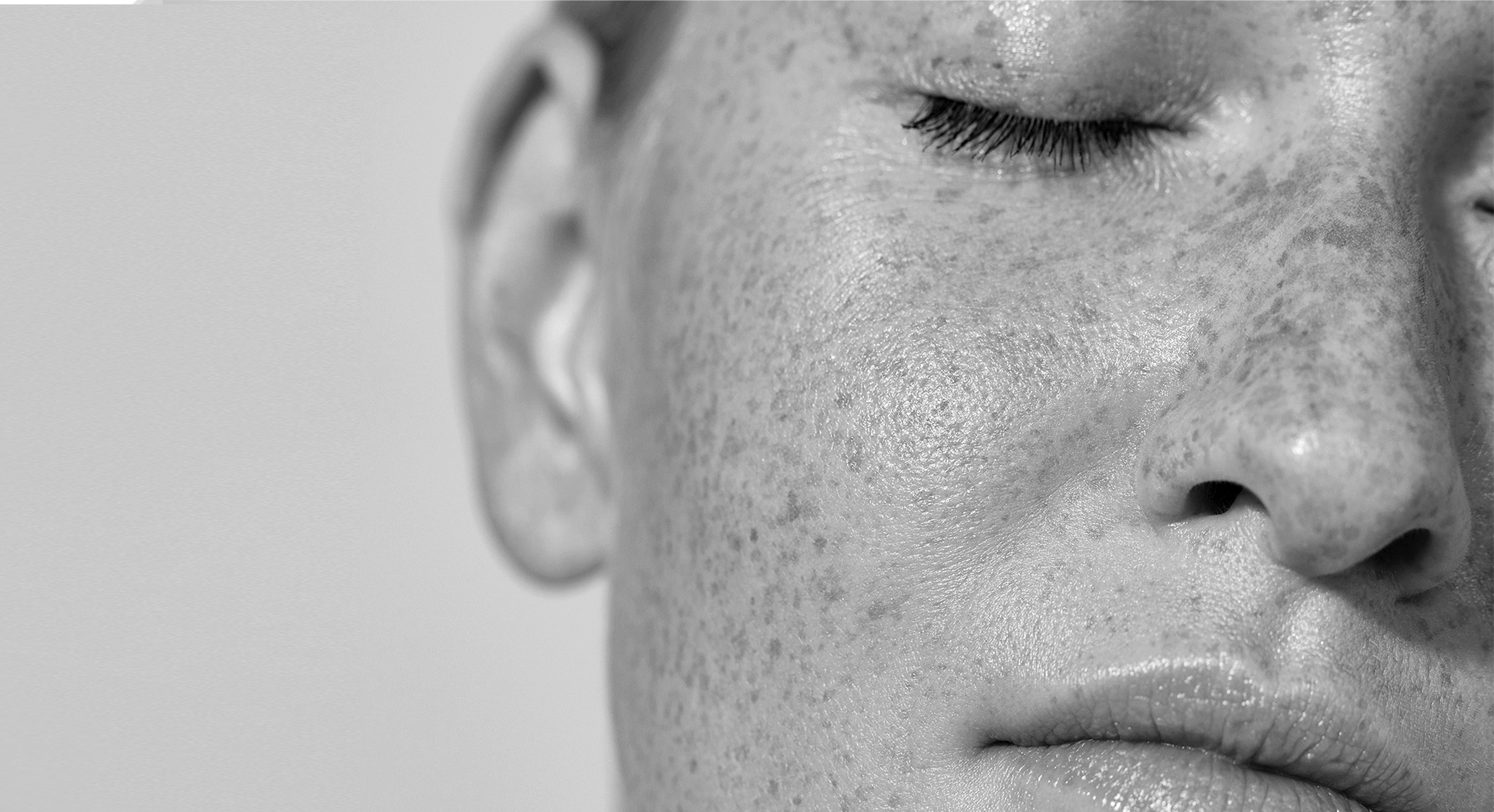 Skin aging: The causes, effects, and how to slow it – Elysium Health