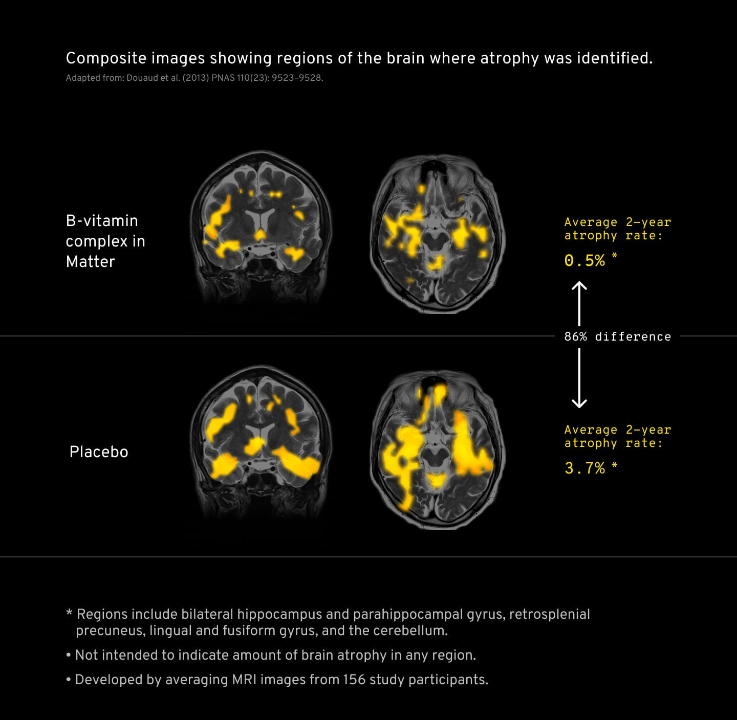 Matter – Tri-Vitamin Complex for Brain Aging | Elysium Health